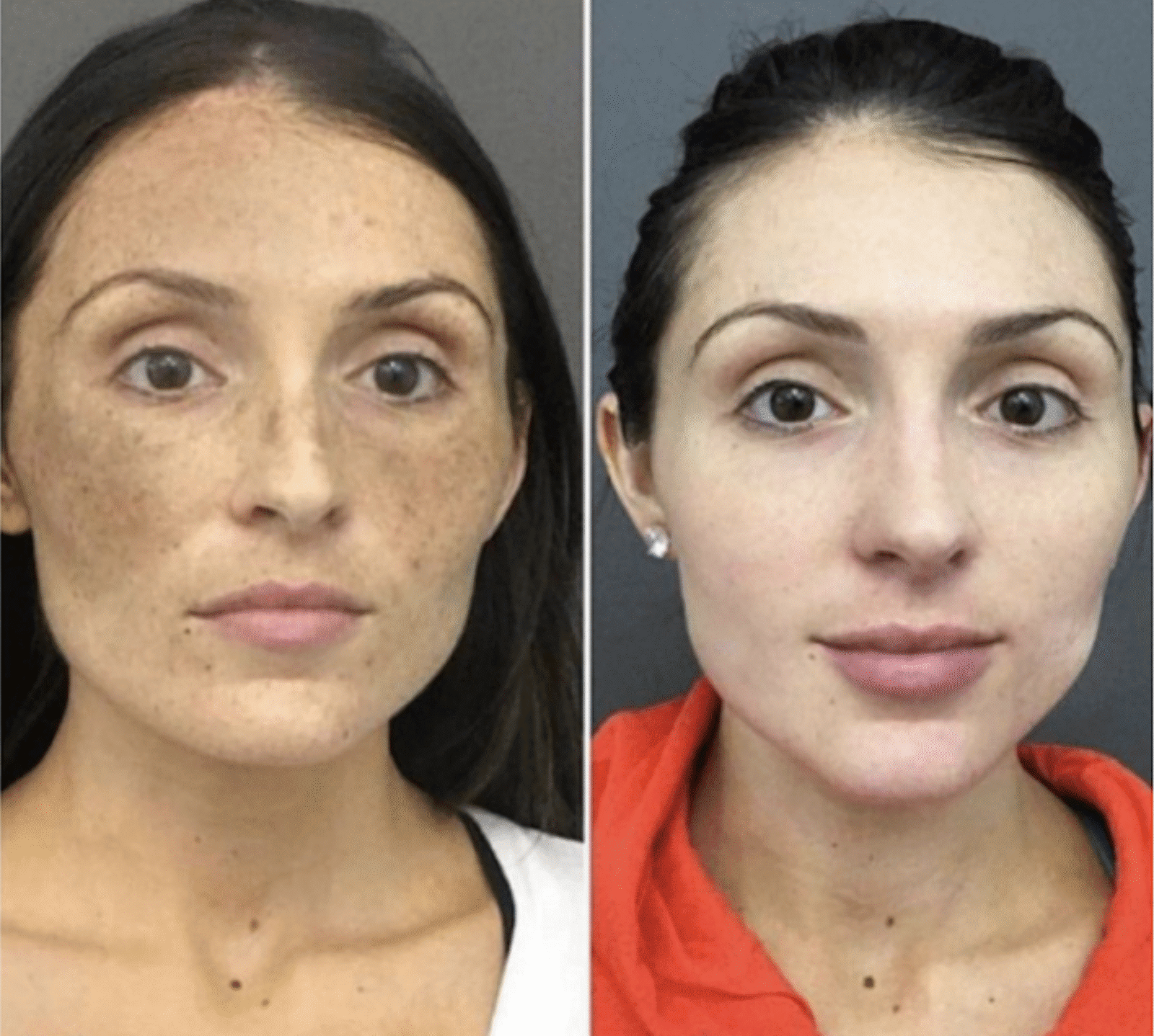 Skin Lightening Treatment – Even Tone Glow at Oxyderm - (780) 863-7561